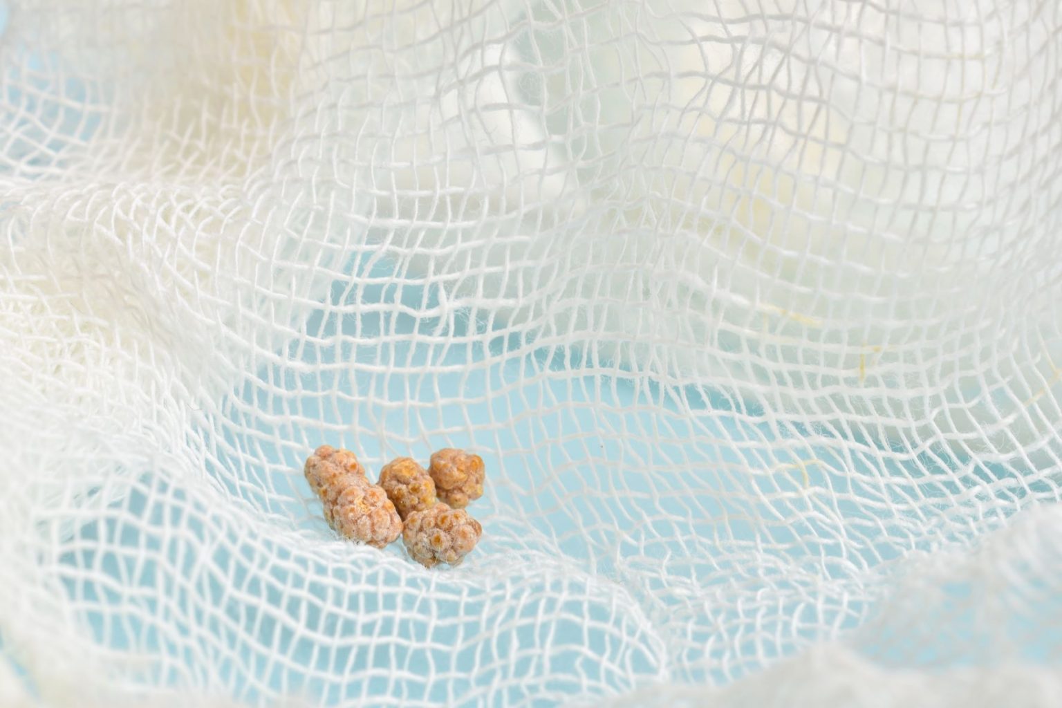 Žlčníková diéta: Viete, ktoré potraviny sú priaznivé pre žlčník?